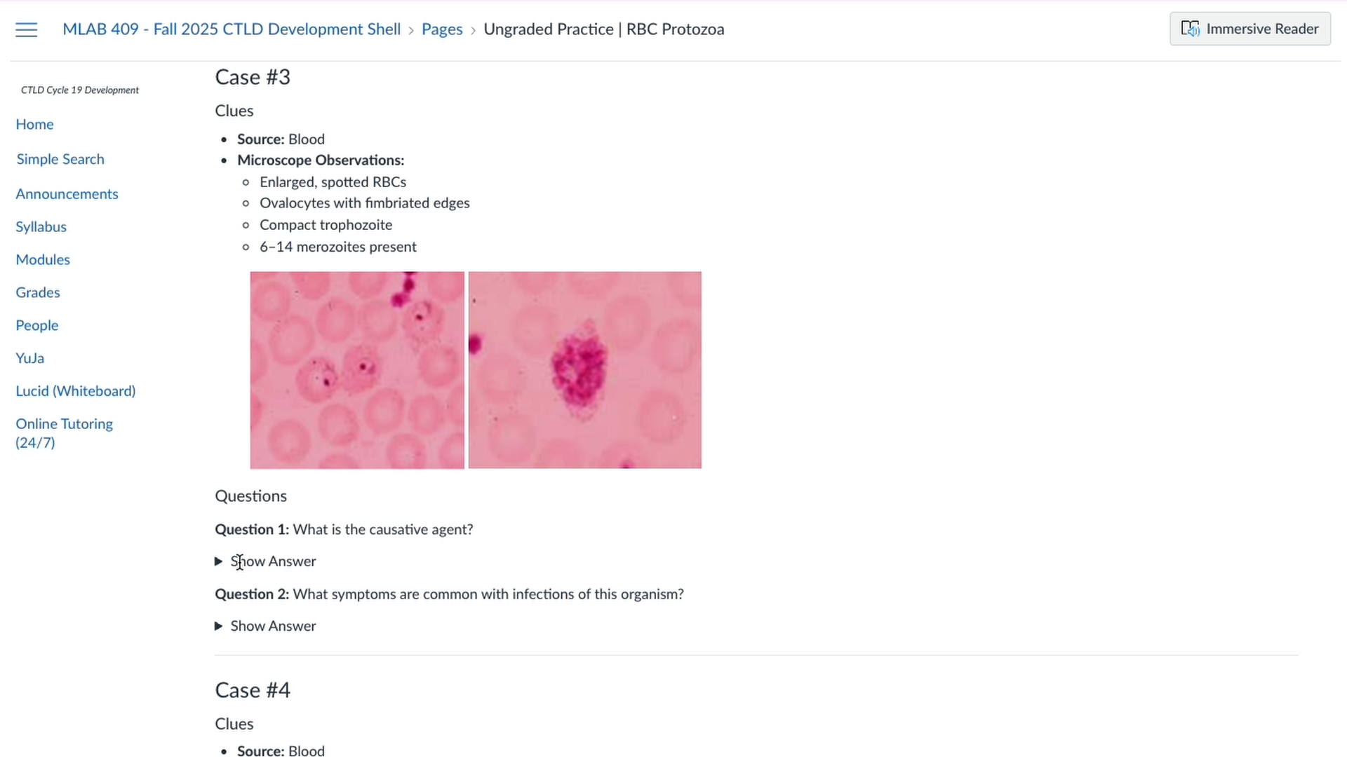 Course Showcase: MLAB 409- Parasitology from the Ground Up - CTLD Ready